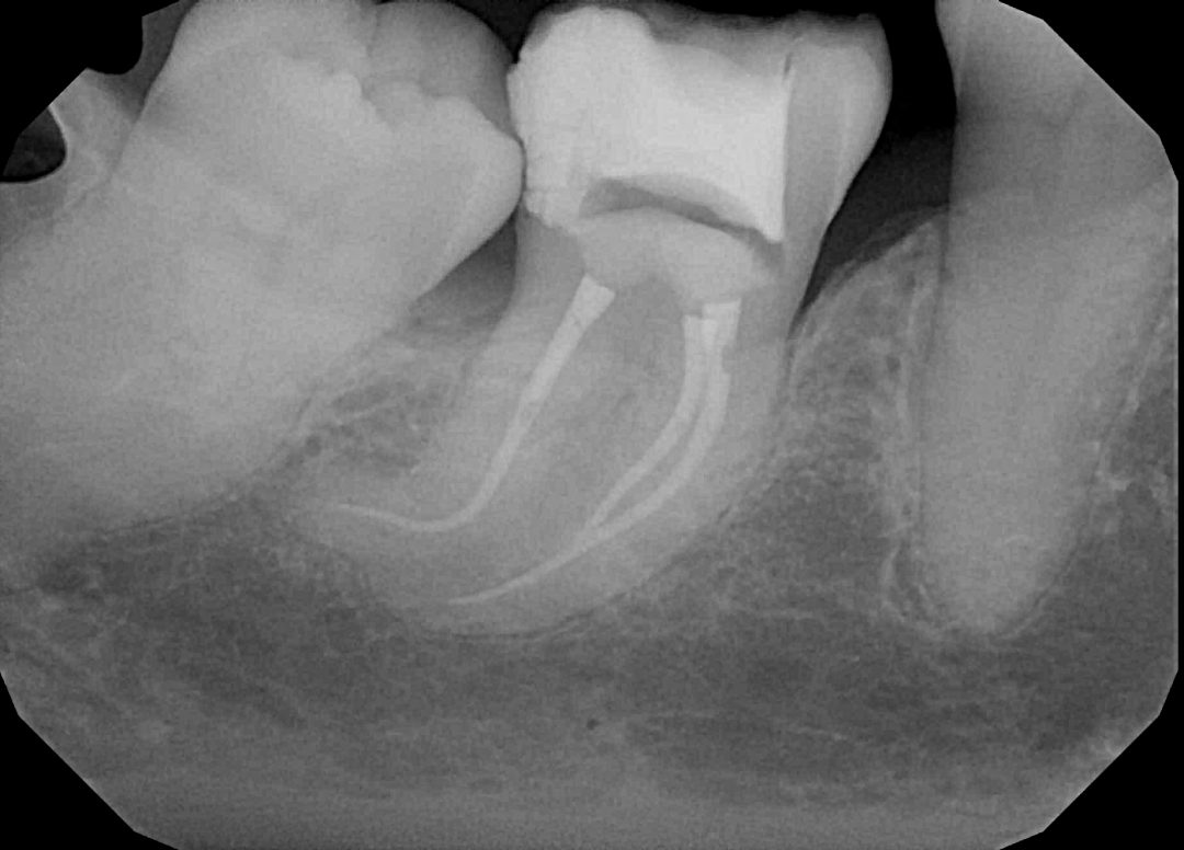 Clinical Cases - EdgeEndo