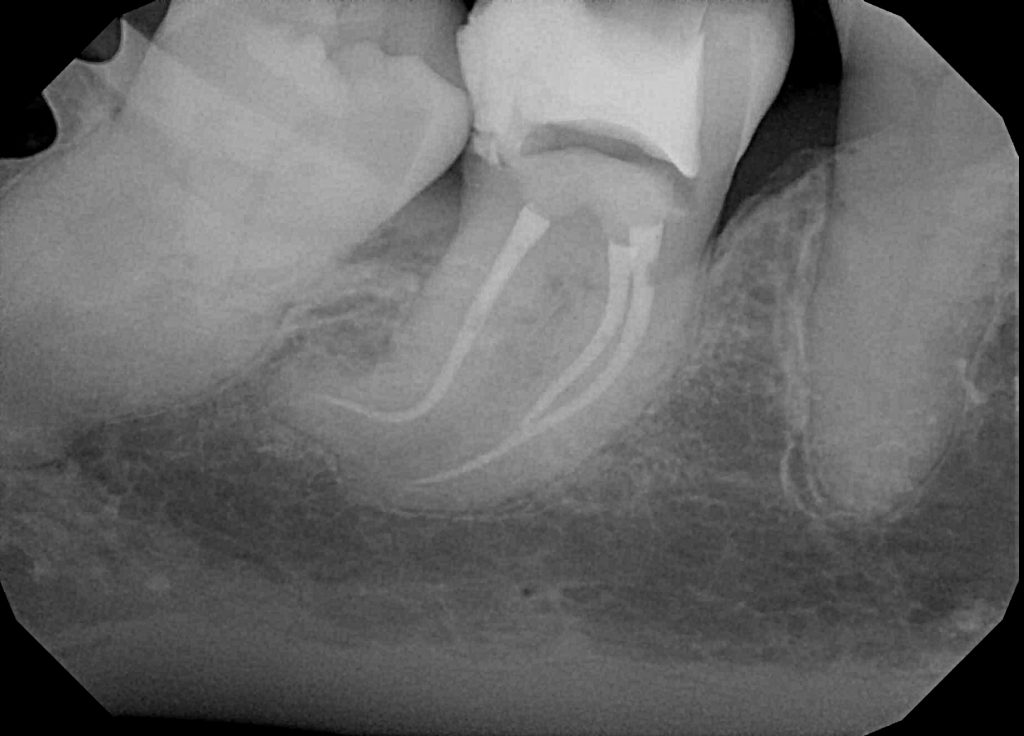 Clinical Cases - EdgeEndo